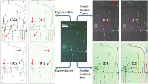 Challenges In Analysis Of Neurite Structure In Image With Low Snr The