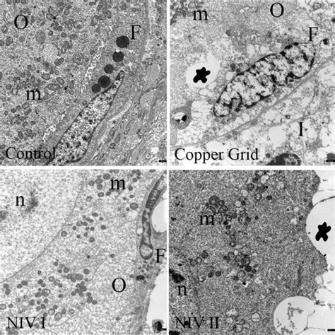 Transmission Electron Microscopy Of Feline Ovary Sections O Oocyte