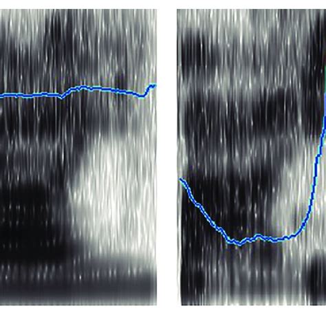 Spectrograms And Pitch Contours Of The Syllable Fai With First And