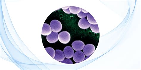 Infecciones Por Estafilococo Aureus Lo Que Todo Especialista Necesita