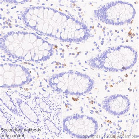 Anti-CD127 antibody [EPR23747-333] (ab259806) | Abcam