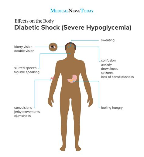 Diabetic Shock Symptoms Complications And Treatment
