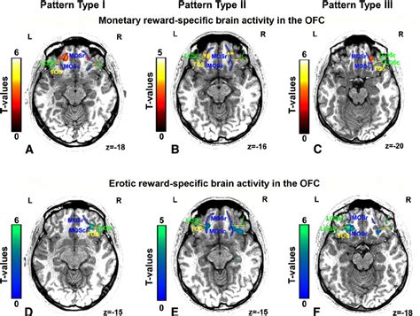 Example Patterns Of Anatomo Functional Organization Of The Ofc Observed