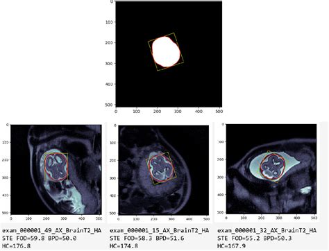 Figure 1 From Fetal Gestational Age Prediction In Brain Magnetic Resonance Imaging Using