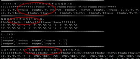基于 Bert Bert 的 医学命名实体识别 文本疾病识别 完整代码数据 可直接运行 硕士毕设 Csdn博客