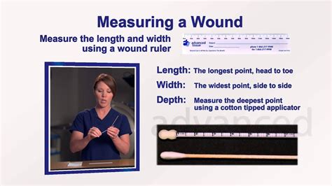 How To Measure Ulcer Size At Lori Chambers Blog