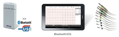 Bluetooth Ecg Wireless Ecg 12 Leads Interpretation Pe 1202 Buy Ecg Wireless Ecg Bluetooth Ecg
