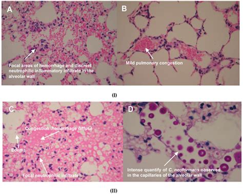 Cryptococcus And Cryptococcosis In Human And Animal Model An Overview