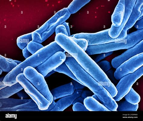 Scanning Electron Micrograph Of Mycobacterium Tuberculosis Particles Colorized Blue The