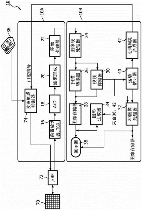 automated heart rate detection for 3d ultrasonic fetal imaging eureka
