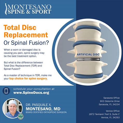 Total Disc Replacement Or Spinal Fusion Spine Docs