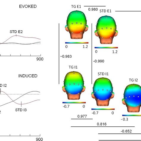 Position Of 58 Scalp Electrodes For Eeg Recording Red Labels Indicate Download Scientific