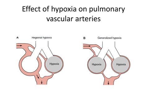 Solution Pulmonary Circulation And Ventilation Perfusion Relationships