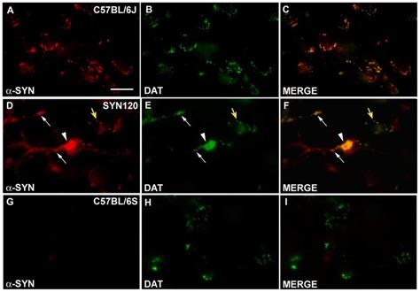 Dat And A Synuclein Double Staining In The Substantia Nigra Dat Green
