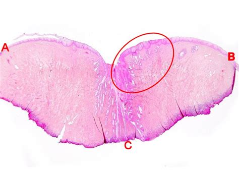 Endocervix Histology