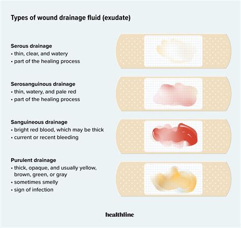 Serous Drainage Color
