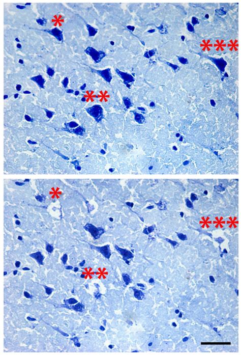 Photomicrograph Of Pyramidal Cells From Layer V From Ventral Bank Of