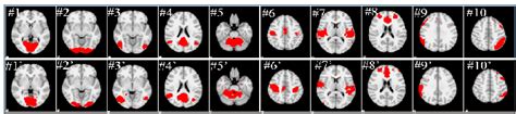 Shows The Examples Of Decoded Auditory Saliency Curves Via The Sparse