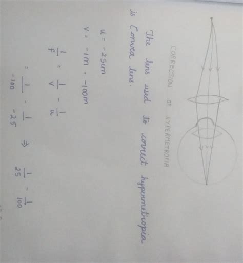 Make A Diagram To Show How Hypermetropia Is Corrected The Near Point Of A Hypermetropic Eye Is