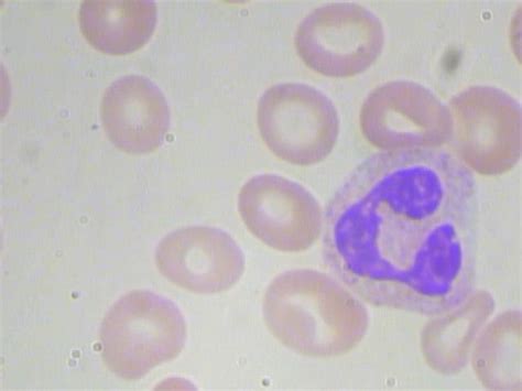 Hw Object Detection Dataset V3 2025 05 14 131pm By Hw