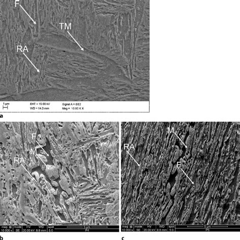 Microstructure Of Investigated Steel After First Intercritical
