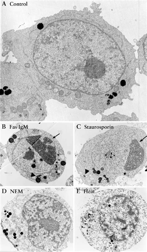 Figure 1 From Comparison Of Comet Assay Electron Microscopy And Flow