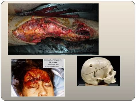 Post Mortem Examination Autopsy Pptx
