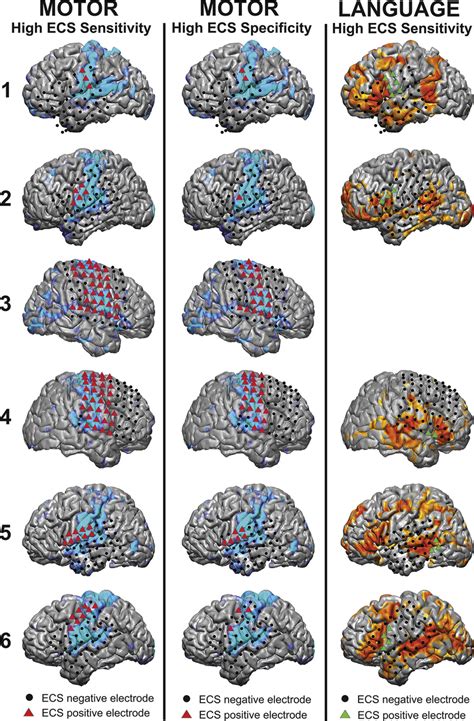 Comparison Of ECS And MLP Results For The Motor And Language Cortex In Download Scientific