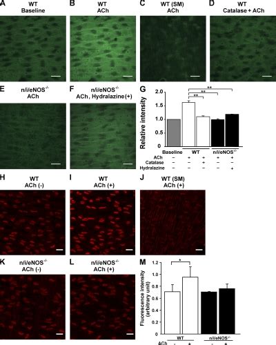 Endothelial Production Of H2o2 And Superoxide In Response To Ach Dcf