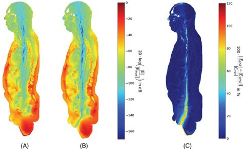 Cut In The Median Plane Of The Big Human Model Hugo” 2 × 2 × 2 Mm³ Download Scientific