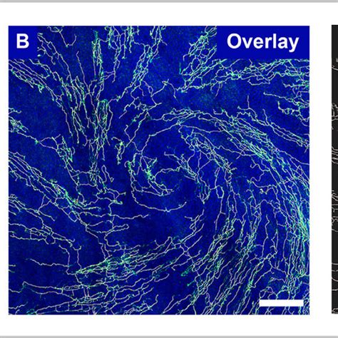 Volumetric Image Segmentation A Standardized Pipeline For Automated Download Scientific