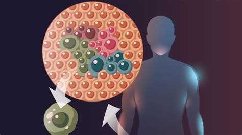 Spatial Transcriptomics In Cancer Infographic Technology Networks