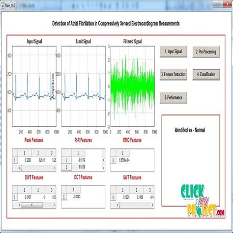 Detection Of Atrial Fibrillation In Compressively Sensed Electrocardiogram Measurements