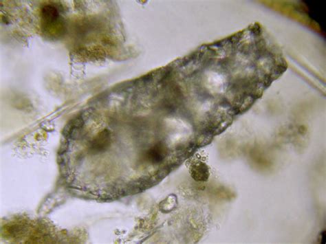 Difflugia Acuminata Rhizopodes And Actinopodes Mikroscopia