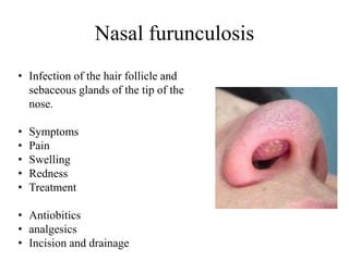 Common Complications Of Diabetes In Earnose And Throat Copypptx