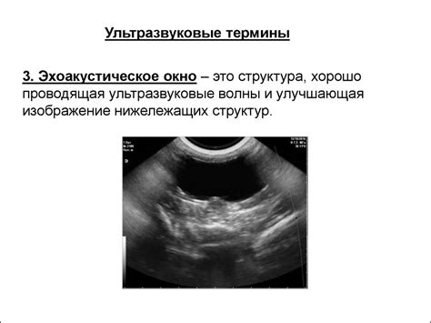Принципы ультразвукового исследования презентация онлайн
