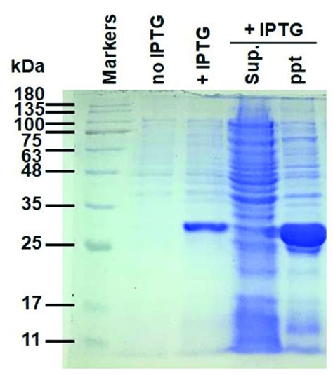Sds Page Of The Recombinant Caleosin Histatin 3 Overexpressed In E