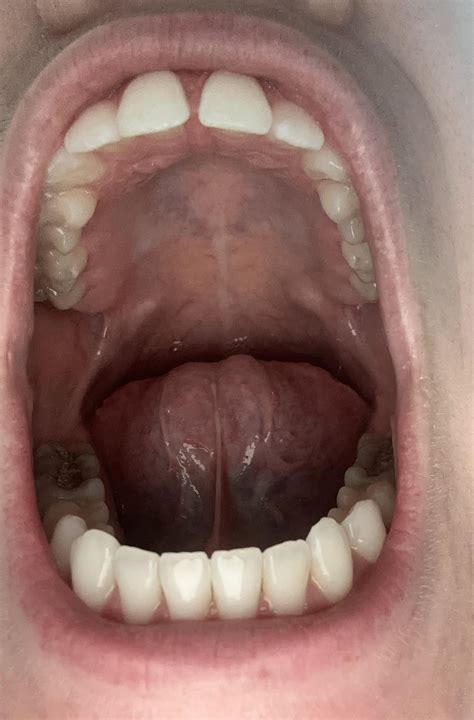 My Mouth Wide Open For You Rmouthtonguelips