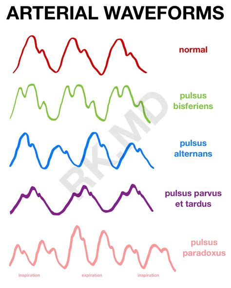 Abnormal Arterial Waveforms Rk Md