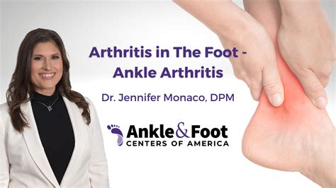 Arthritis In The Foot Ankle Arthritis Jenn Monaco Dpm