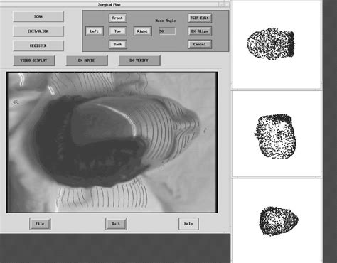 Example Of Graphical Interface Used To Obtain Initial Alignment