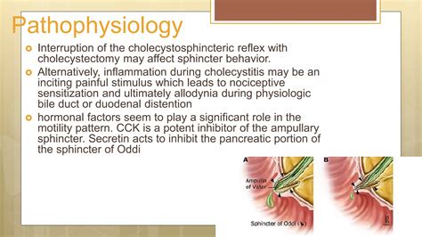 Sods Sphincter Of Oddi Dysfunction Pptx