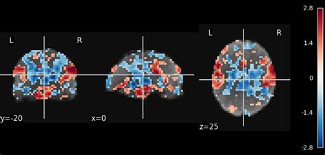 Multivariate Decompositions Independent Component Analysis Of Fmri
