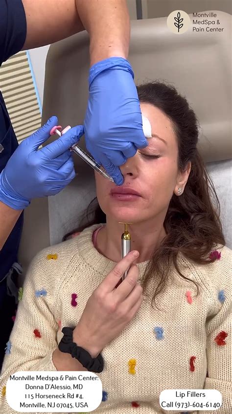 Vascular Occlusion Lip Filler Everything You Need To Know