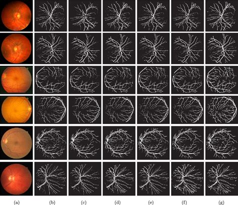 Segmentation Results Of Different Methods A Original Images B