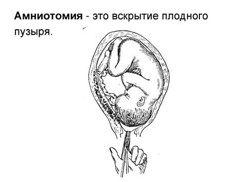 Акушерские операции - презентация онлайн