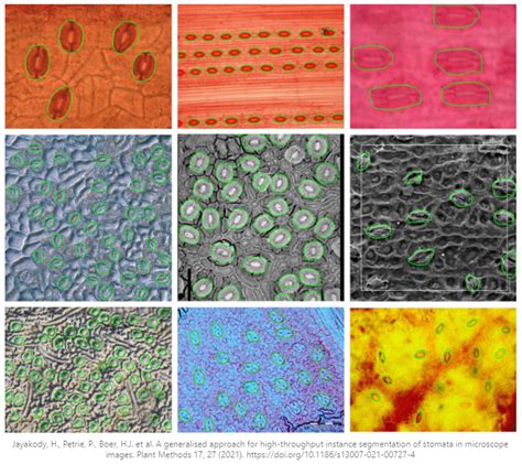 Plant Stomata Detection Plant Stomata Encyclopedia