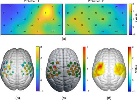 Nirs Kit A Matlab Toolbox For Both Resting State And Task Fnirs Data Analysis