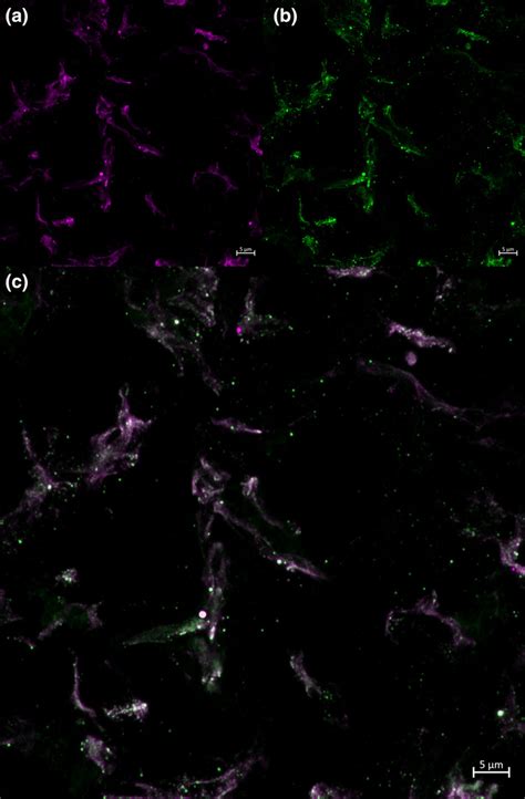 This Image Illustrates The Distinct Staining Pattern Of Cd68 And Vegf Download Scientific
