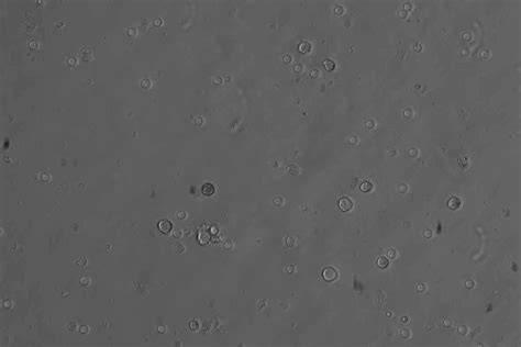 Artificial Tail Less Sperm Is The Best Test Tube Sex Cell Yet New Scientist